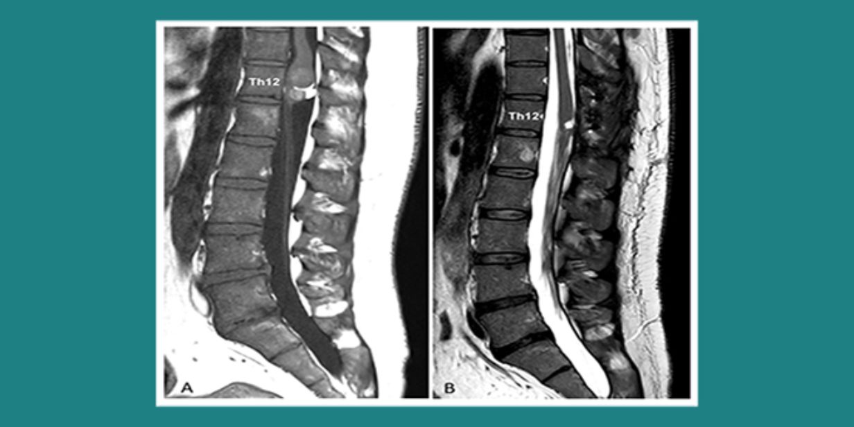 Sektion Rückenmarkchirurgie - Asklepios Fachkrankenhaus Bad Abbach