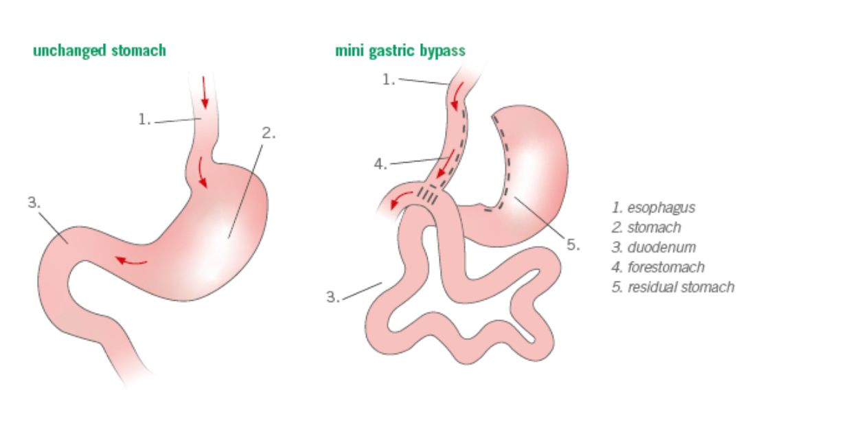 obesity clinic - Asklepios Westklinikum Hamburg