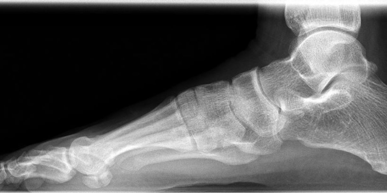 Digitales konventionelles Röntgen - Asklepios Klinik Lich