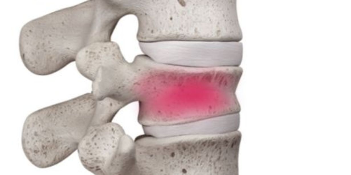 Wirbelbruch/Beckenbruch - Asklepios Klinik Lindau