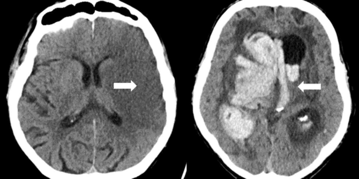 Neurologie und Akutneurologie - Klinik Weißenfels