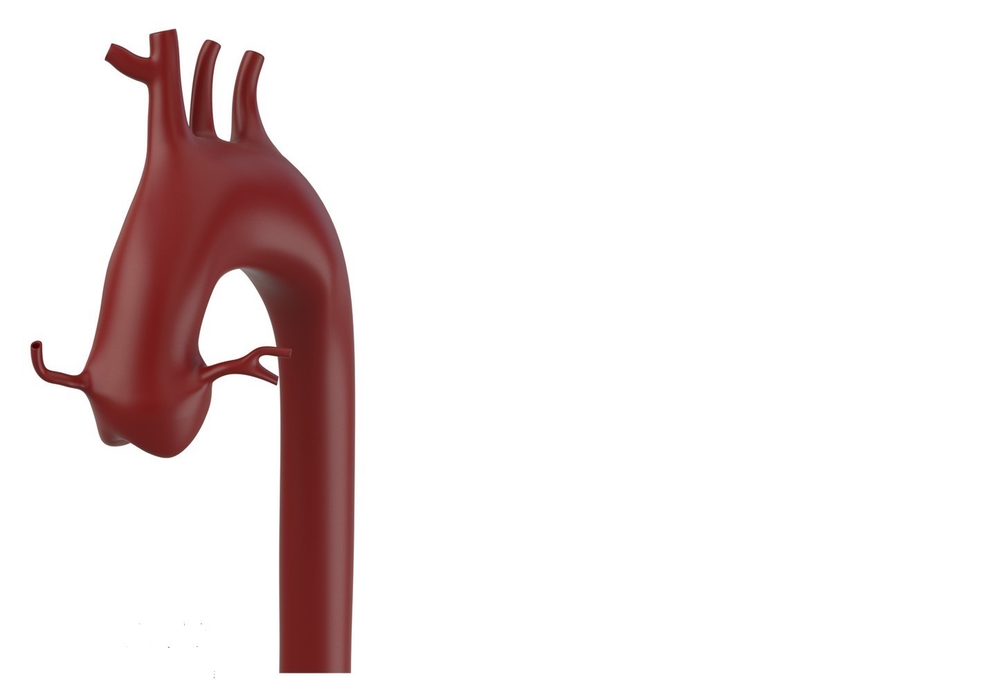 Chirurgie der Brustkorbhaupschlagader (Aorta thorakalis) - Asklepios ...